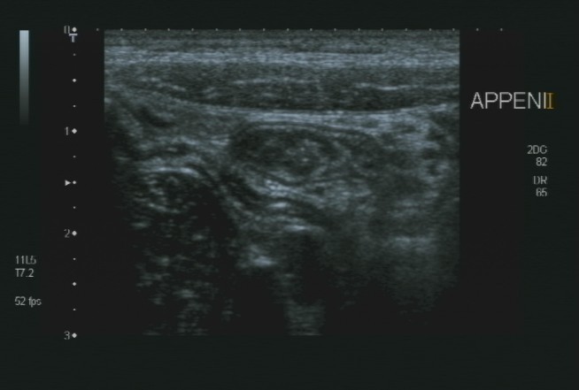 Endoscopia Digestiva di Celano - Ecografie